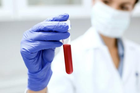 Breakthrough Study Makes Cancer Detection Possible With a Simple Blood ...